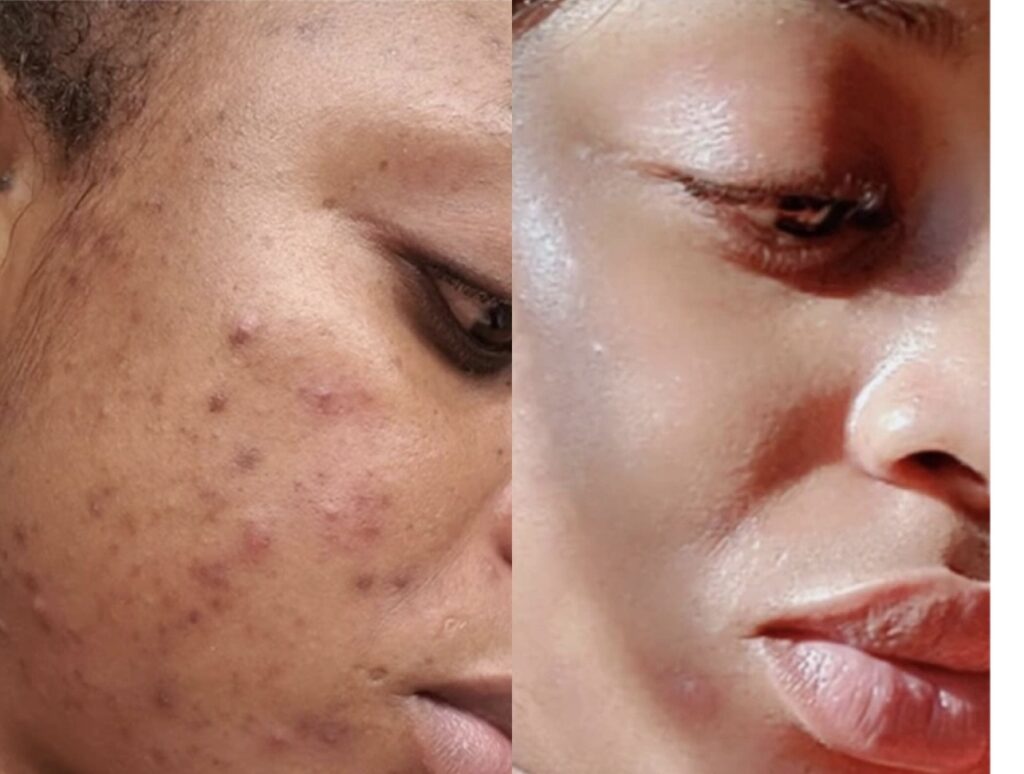 3PCS Byen Blan 2X Strong Turmeric milk Soaps$35 – ishop BeautyandBeyond ...