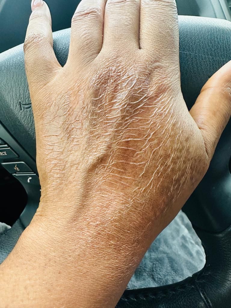 Byen Blan 2 Xtra Strong Turmeric Diva $650 – ishop BeautyandBeyond ...