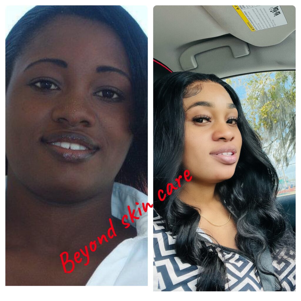 Byen Blan 2 Xtra Strong Turmeric Diva $650 – Byenblan.com |Skin Care ...