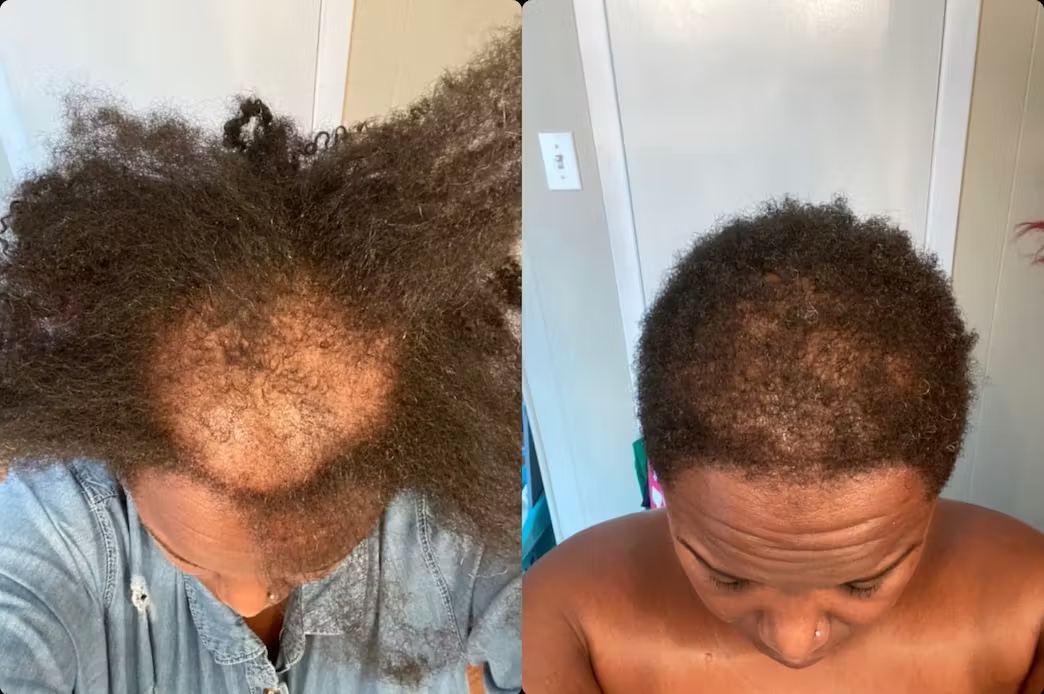 Hair Grwoth Set $100 – Byenblan.com |Skin Care Product | HairCare ...